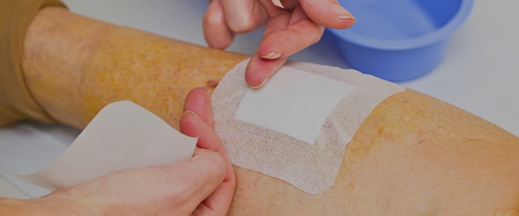 How to Manage Allergy to Adhesive Bandages and Tapes – MY Healthy Balance