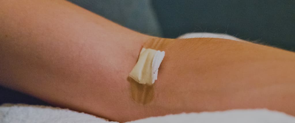 How to Manage Allergy to Adhesive Bandages and Tapes – MY Healthy Balance